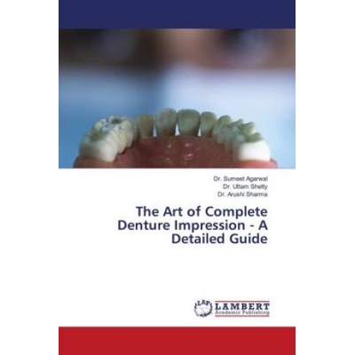The Art of Complete Denture Impression - A Detailed Guide od 61,48 ...